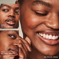 Blemish Fighting Putty Primer For Acne Prone Skin w/ Salicylic Acid | e ...